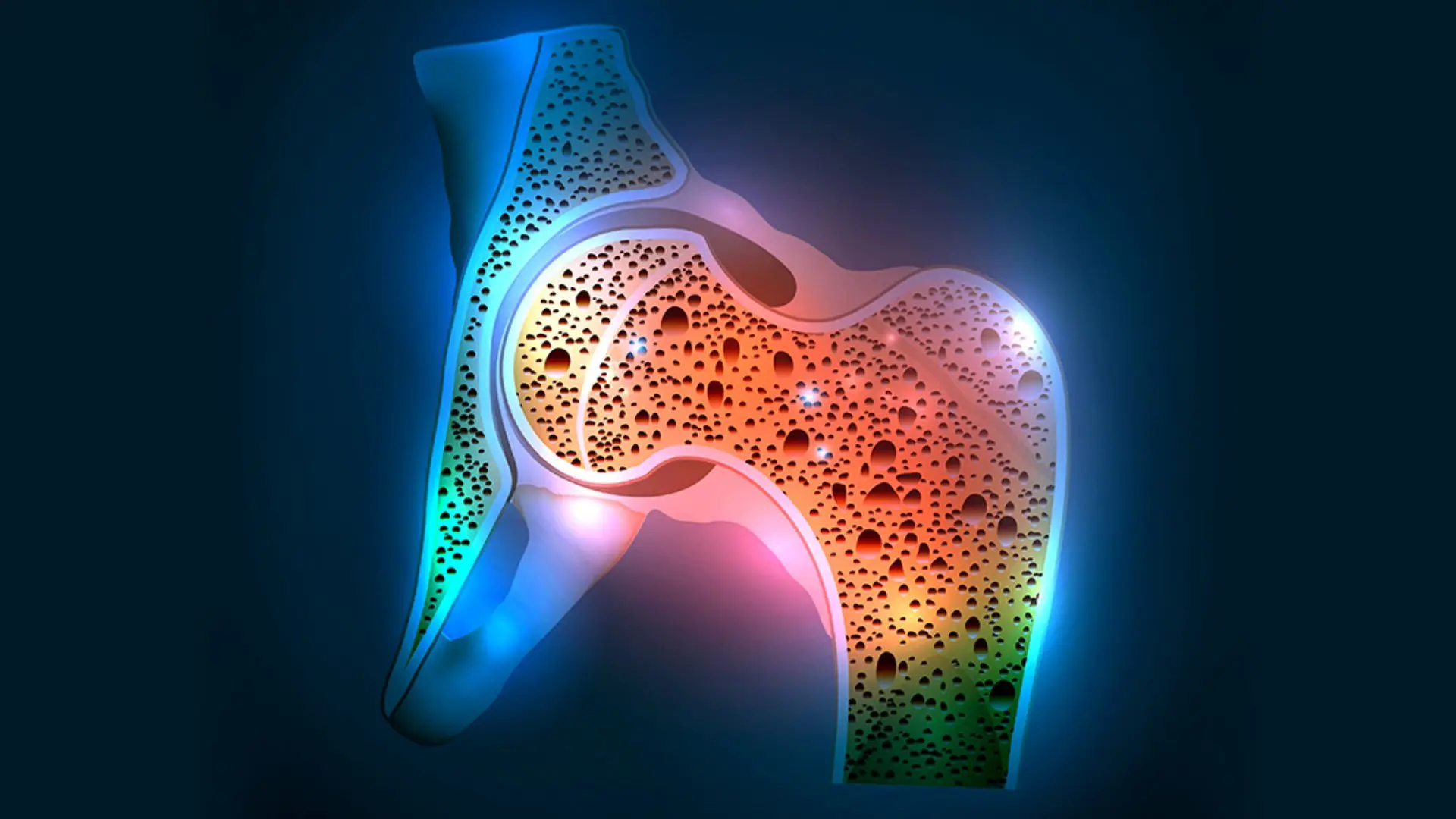 Osteomalazie: Wenn Knochen weich werden | ndr.de