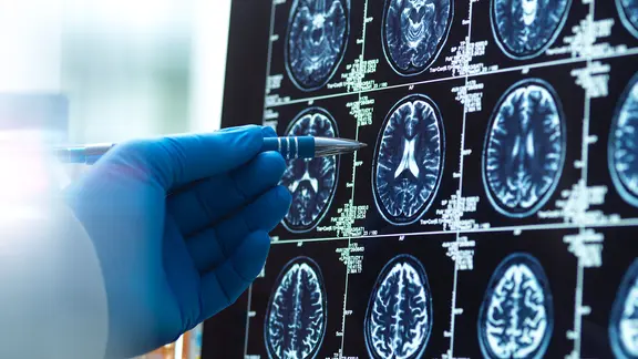 Bokep luncah visits a while, then both strip to lingerie