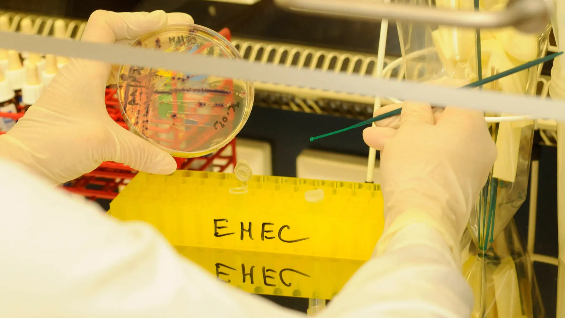 Deutlicher Anstieg bei EHEC-Infektionen in MV - Ursache weiter unklar | ndr.de