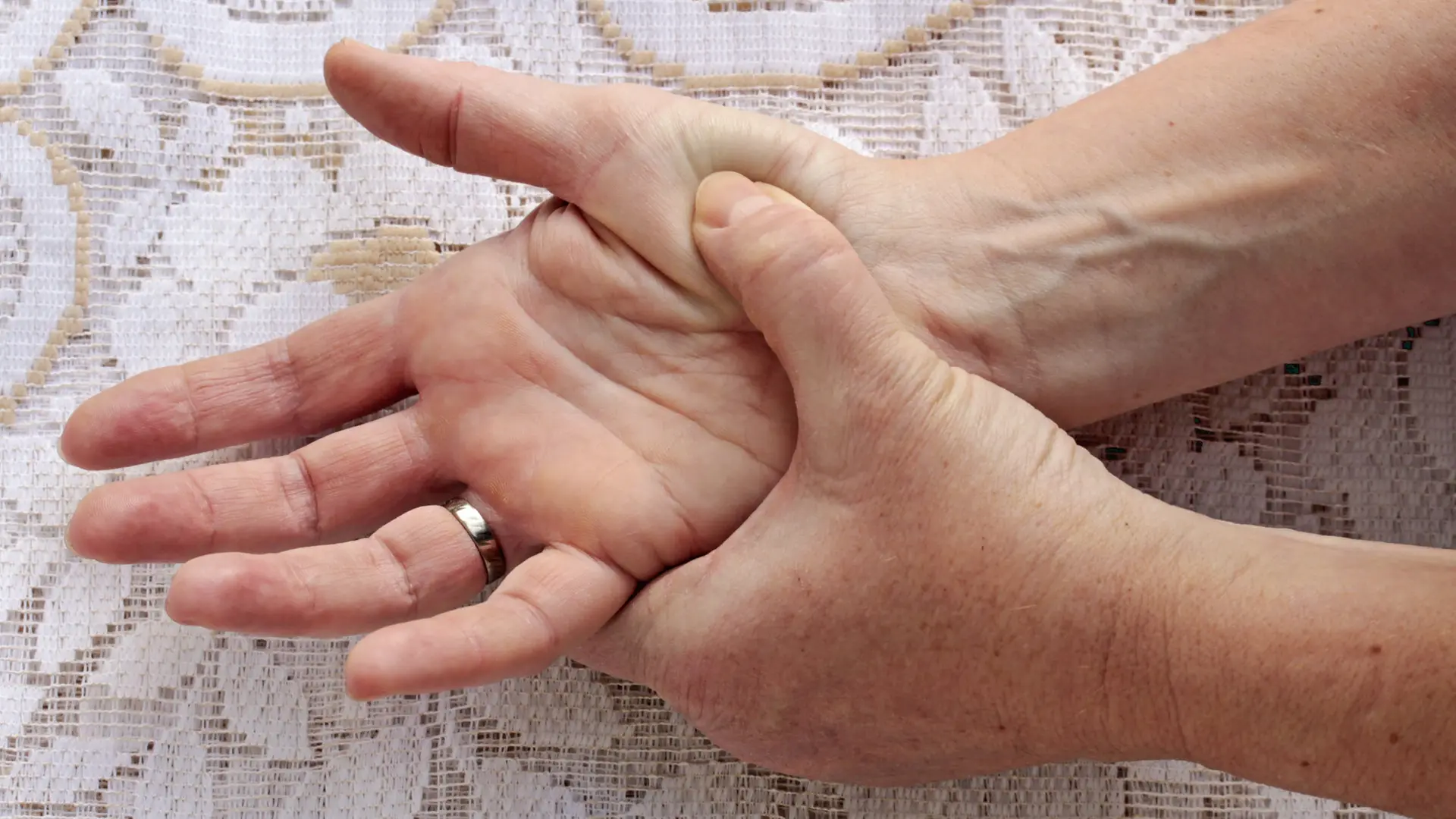 Schmerzhafte Rhizarthrose: Ursachen, Diagnose, Therapien | ndr.de