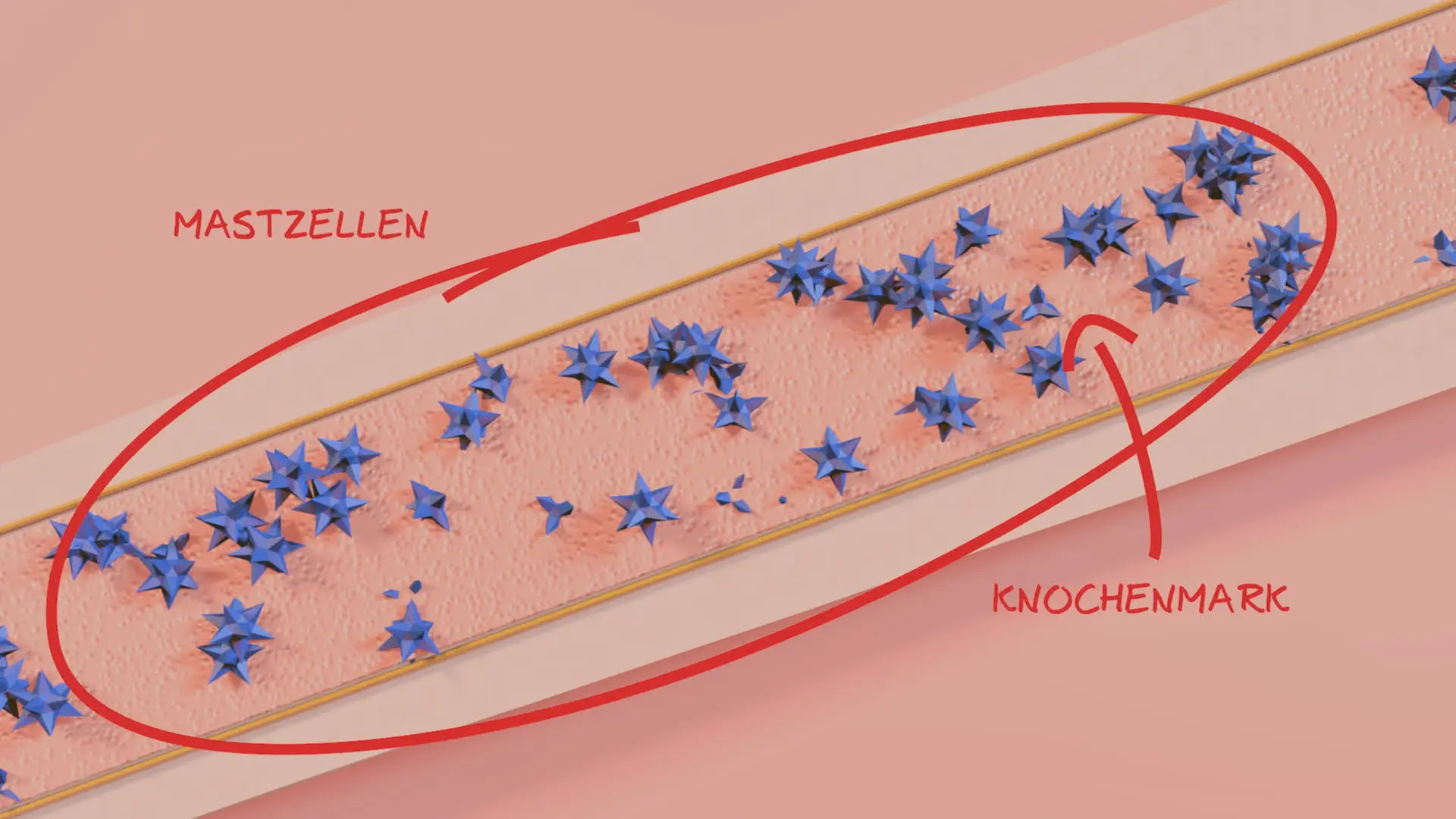 Mastozytose: Symptome, Diagnose und Behandlung | ndr.de