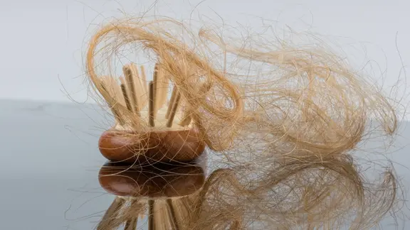 Alopecia Areata: Leben mit plötzlichem Haarausfall | ndr.de