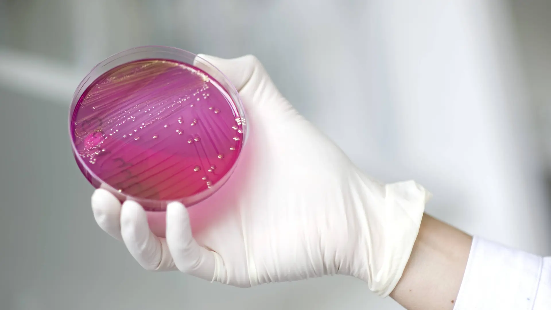 EHEC-Ausbruch: Weitere elf Infektionen in MV | ndr.de