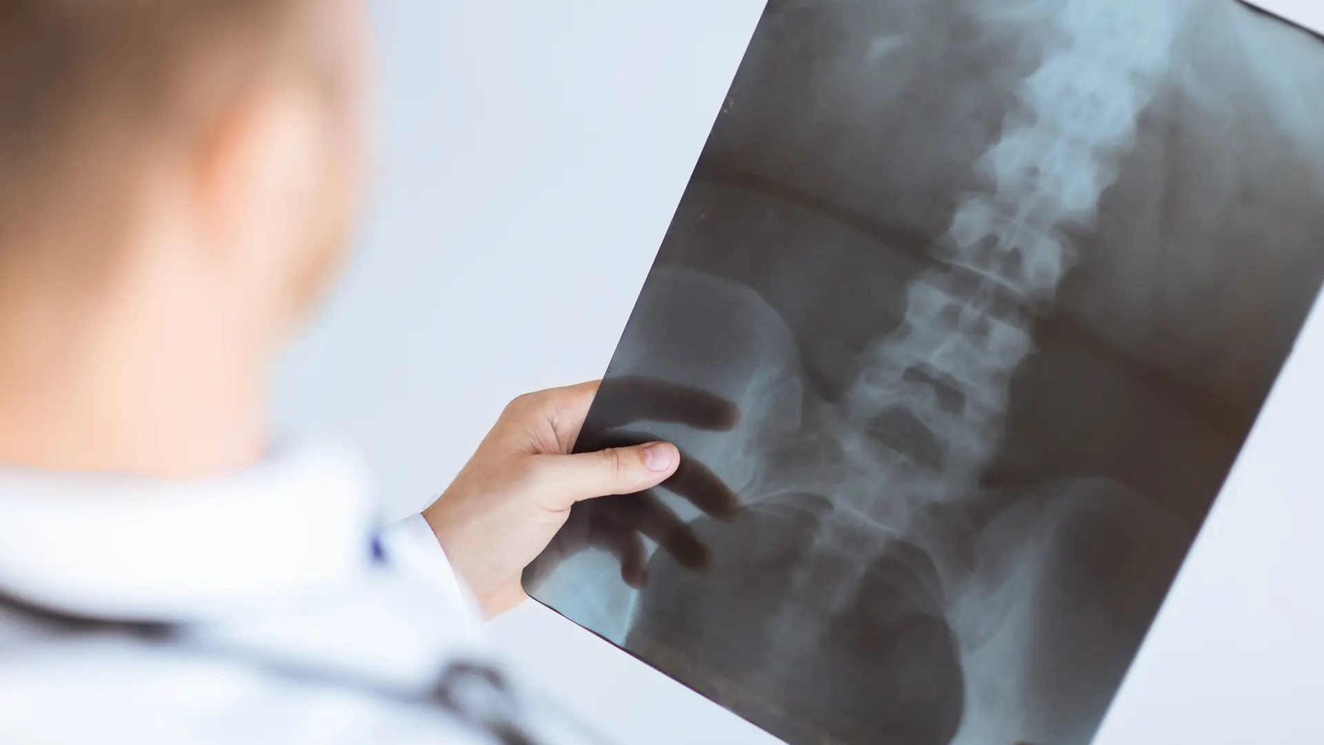 Reductio! Implantate, die von selbst verschwinden… | ndr.de