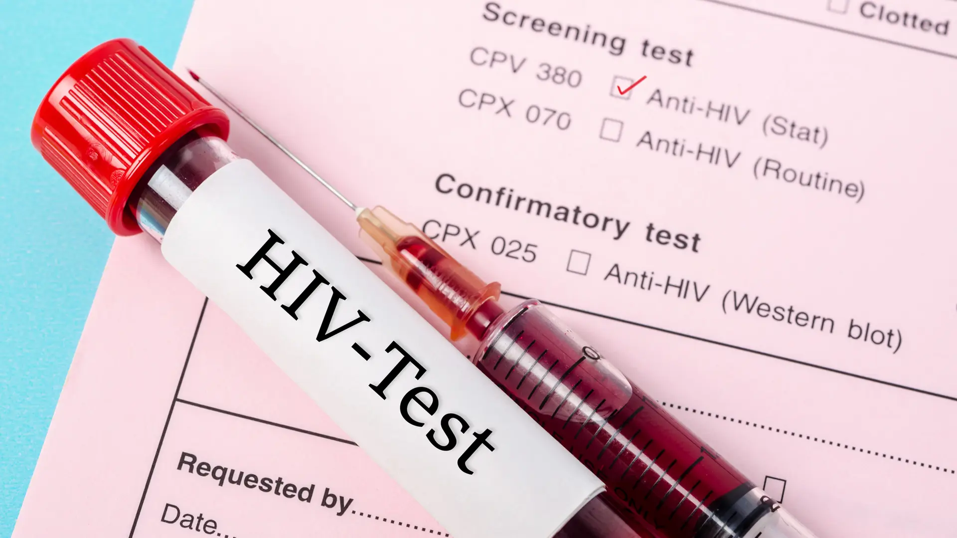 Aids: Ansteckung mit HIV, Symptome und Behandlung | ndr.de