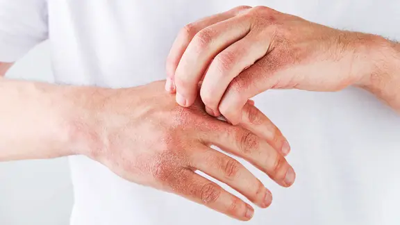 Jodmangel: Symptome und jodhaltige Lebensmittel | ndr.de