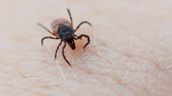 Erysipel: Symptome, Ursachen, Therapie bei Wund- oder Gesichtsrose | ndr.de